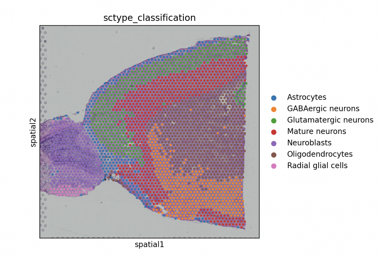 scType的功能又双叒叕更新啦！反卷积算法为空间转录组细胞类型注释赋能！ – 云生信