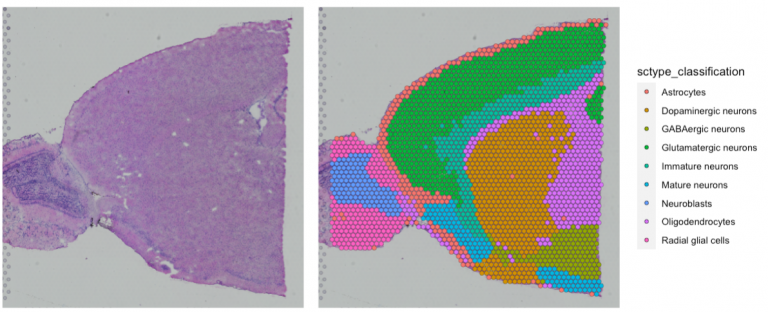 scType的功能又双叒叕更新啦！反卷积算法为空间转录组细胞类型注释赋能！ – 云生信